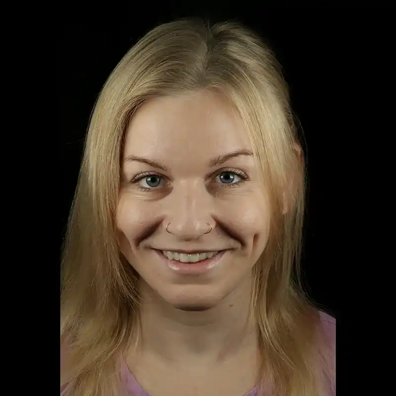 Meet the team - Hanham Dental Bristol