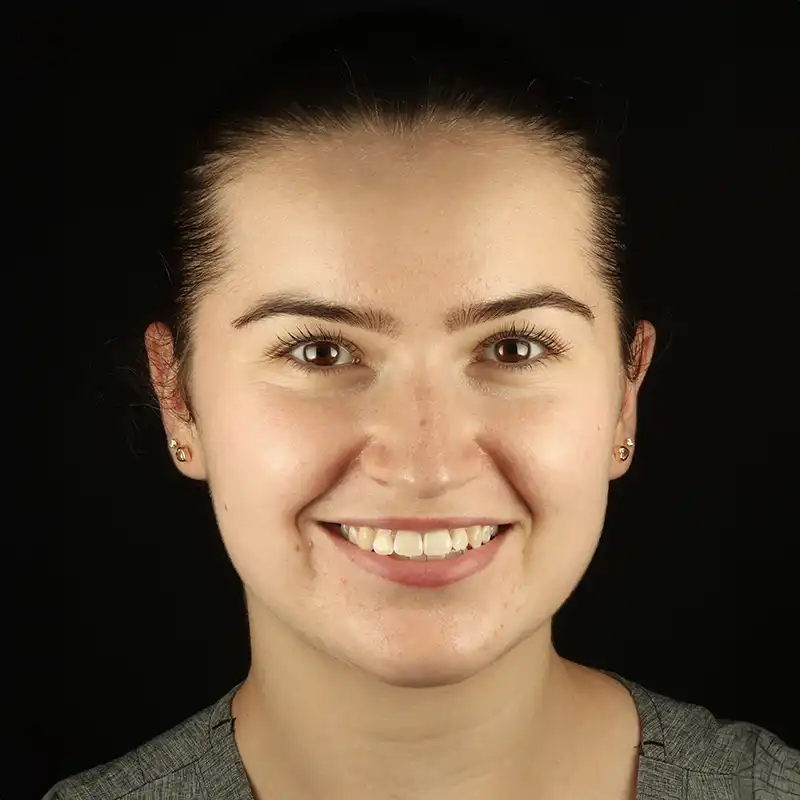 Meet the team - Hanham Dental Bristol